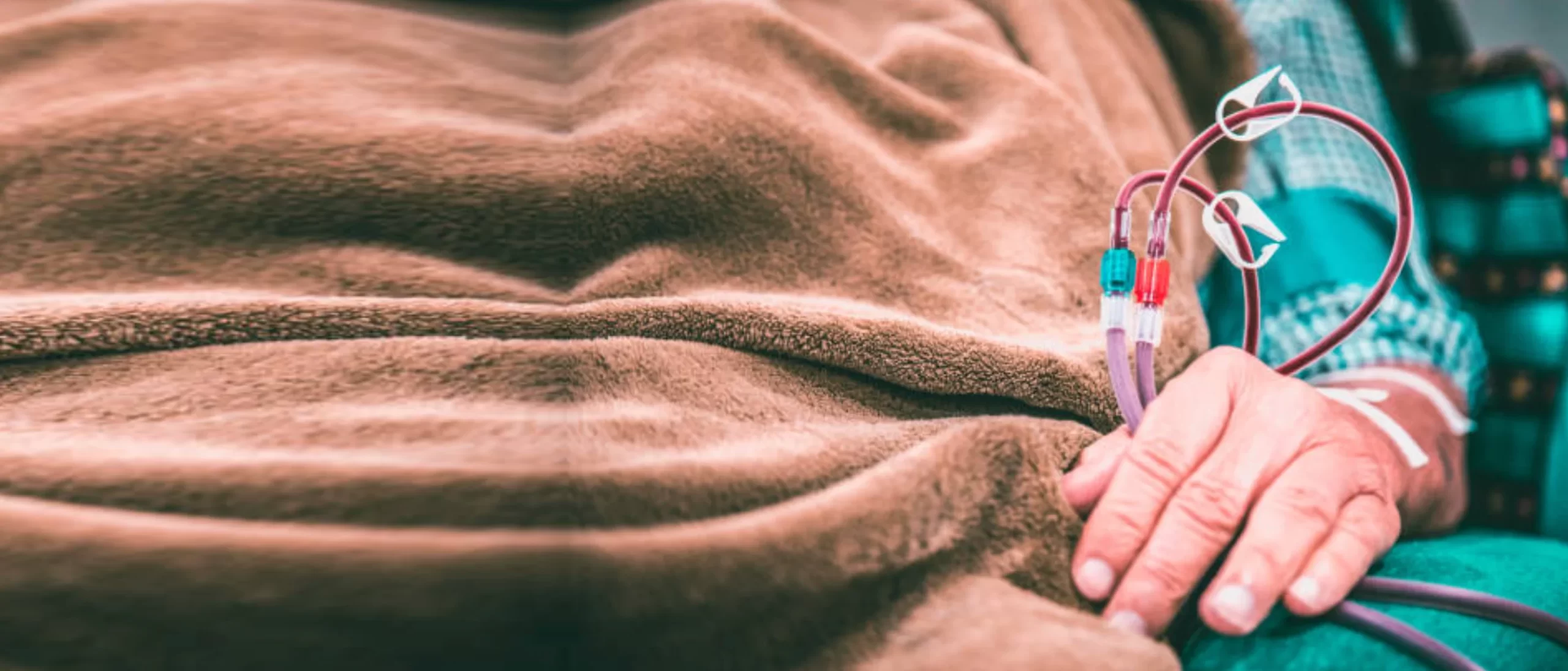 Velseal-Patch- “A novel solution for bleeding problems in post ...