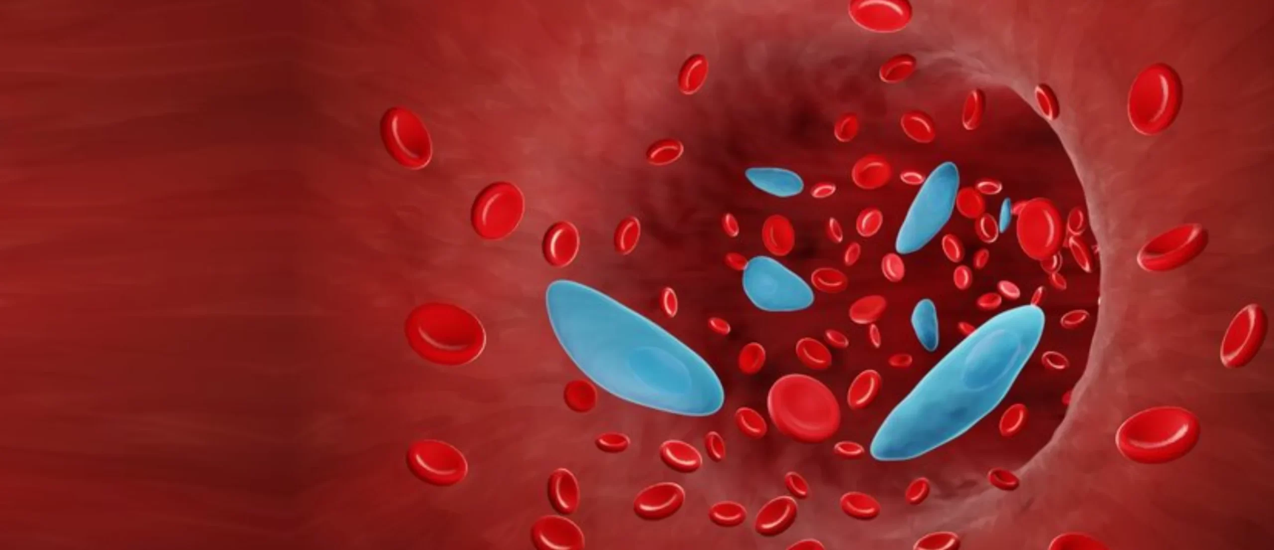 Preventing Catheter-Related Blood Stream Infections With VELVERT-DISC ...