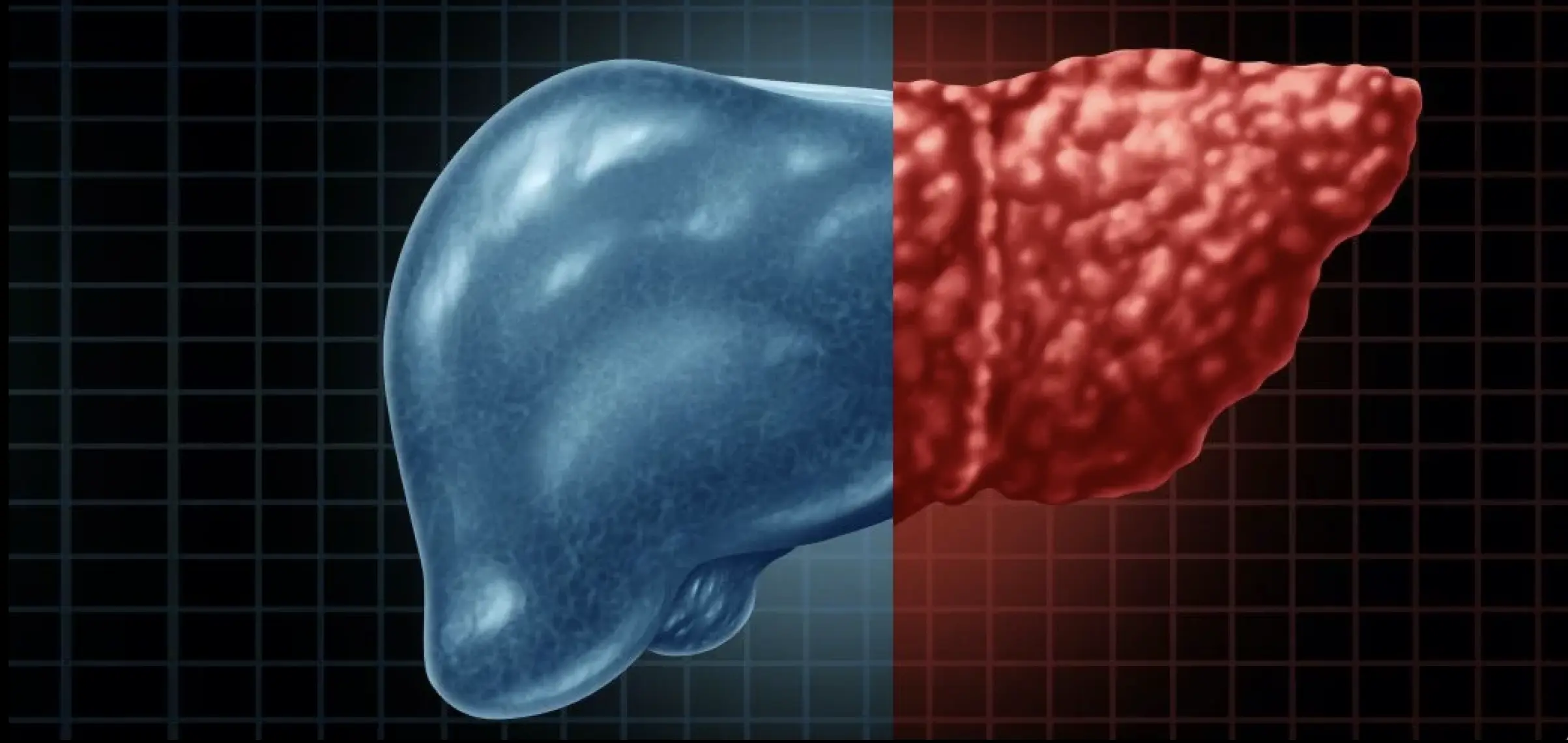 The Advanced Stages - Liver Diseases - Datt Mediproducts Knowledge Hub