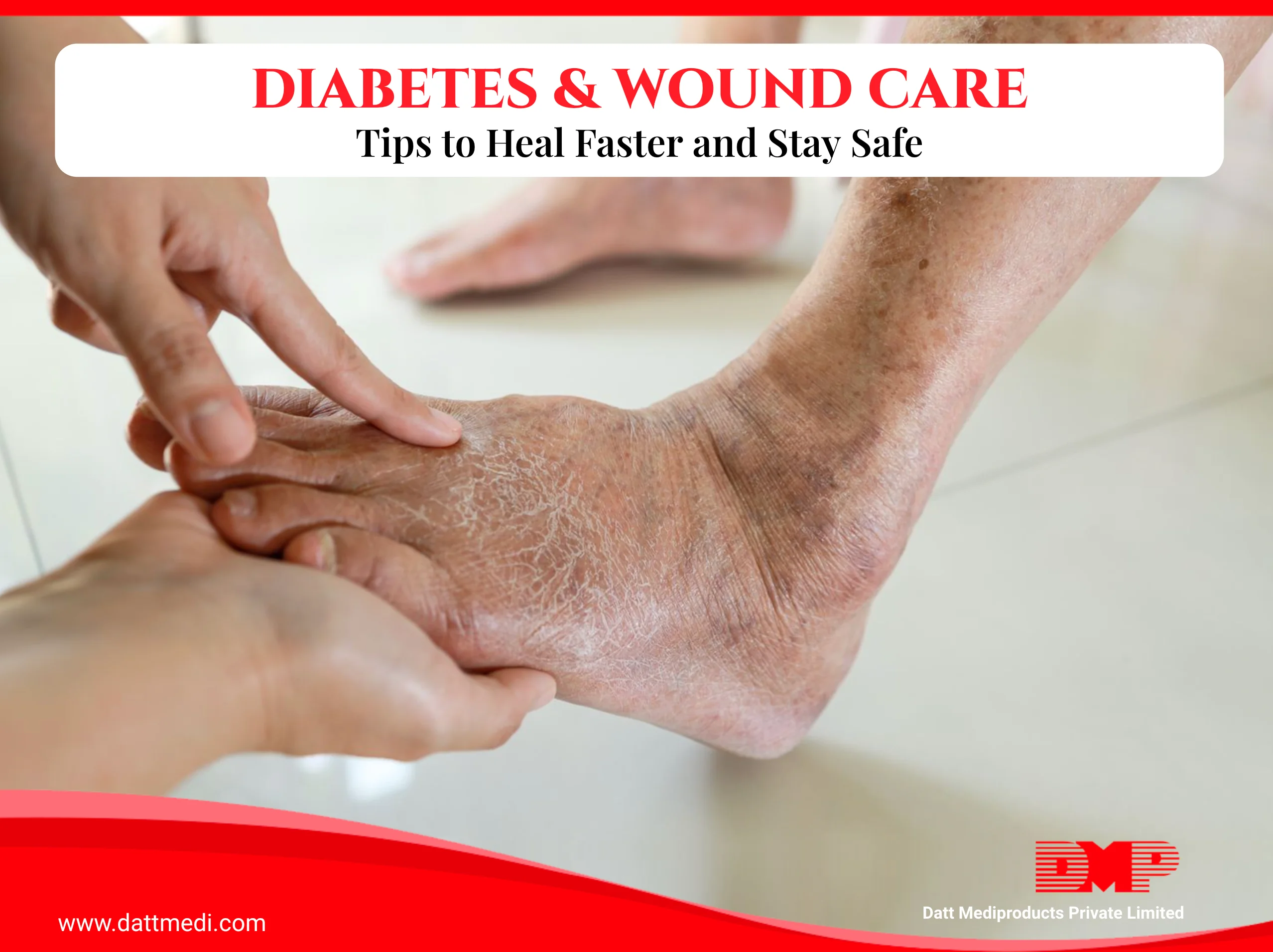 Wound Care Tips for Diabetic Patients - Smart Care & Healing
