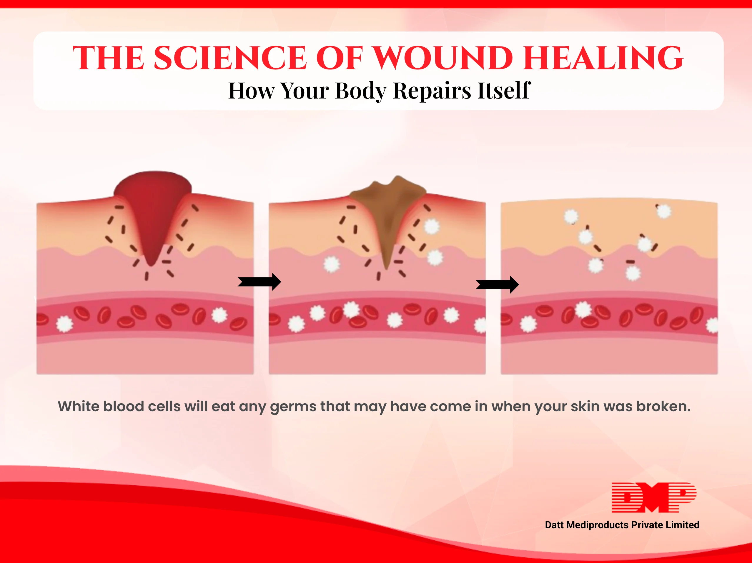 The Science of Wound Healing: How Your Body Repairs Itself - Datt ...